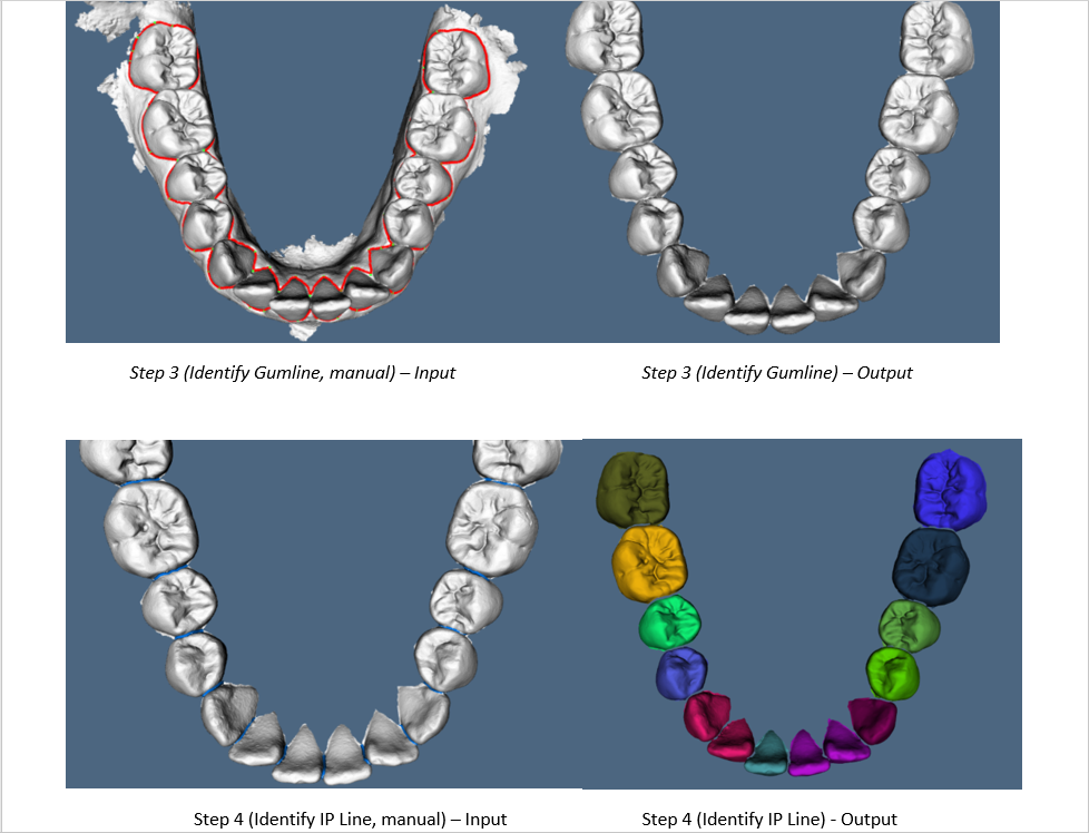 Teeth Segmentation – Syed Haroon Alam