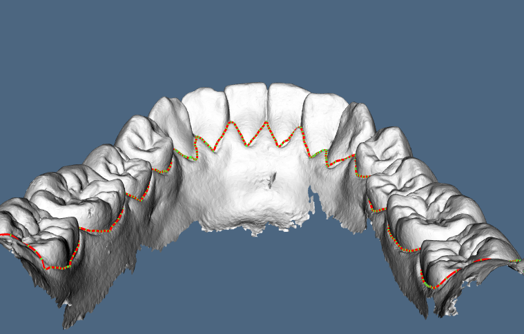 Teeth Segmentation – Syed Haroon Alam
