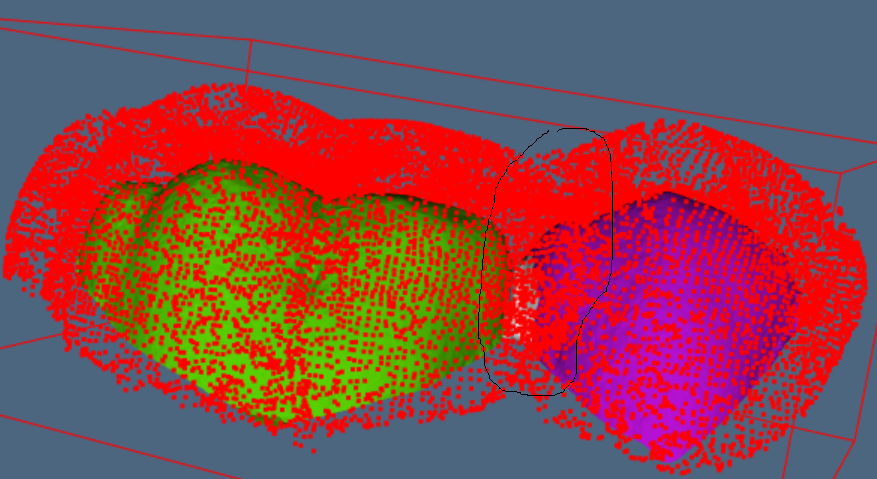 Teeth Segmentation – Syed Haroon Alam