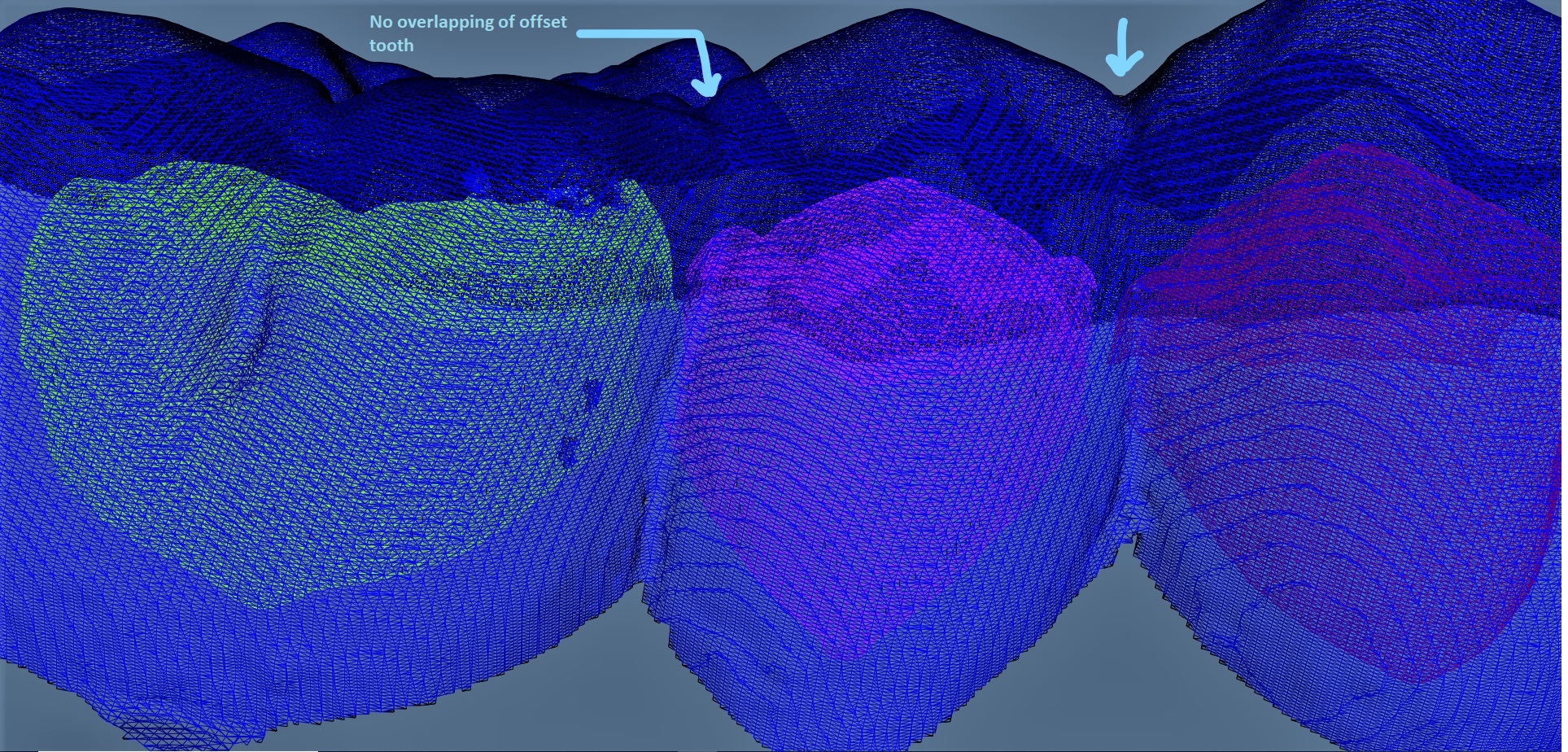 Teeth Segmentation – Syed Haroon Alam