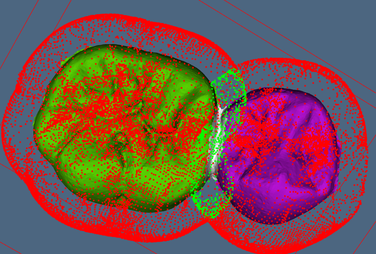 Teeth Segmentation – Syed Haroon Alam